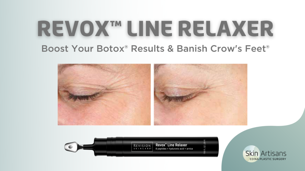 Boost your Botox® Results & Banish Crow’s Feet with REVOX™ Line Relaxer ...