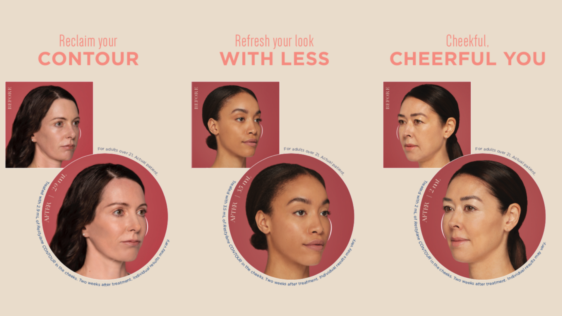 Reclaim Your Angles with Restylane® Contour - Skin Artisans Skin Artisans