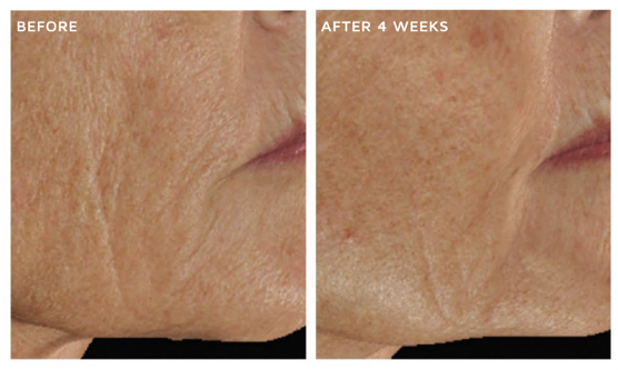 Go PRO with Your Glow! DefenAge® PRO EXCLUSIVE Platinum Edition - Skin ...