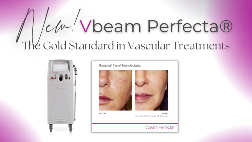 NEW! Vbeam Perfecta® – The Gold Standard in Vascular Treatments - Skin ...