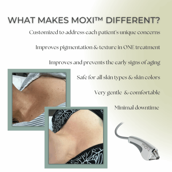 MOXI™ VS HALO™ – Which Laser Treatment is Right for You? - Skin Artisans